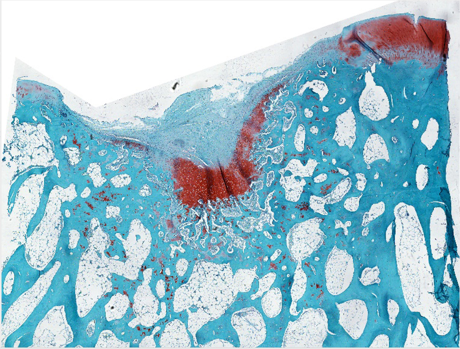 Scientists discover a way to regrow damaged cartilage - Good.is