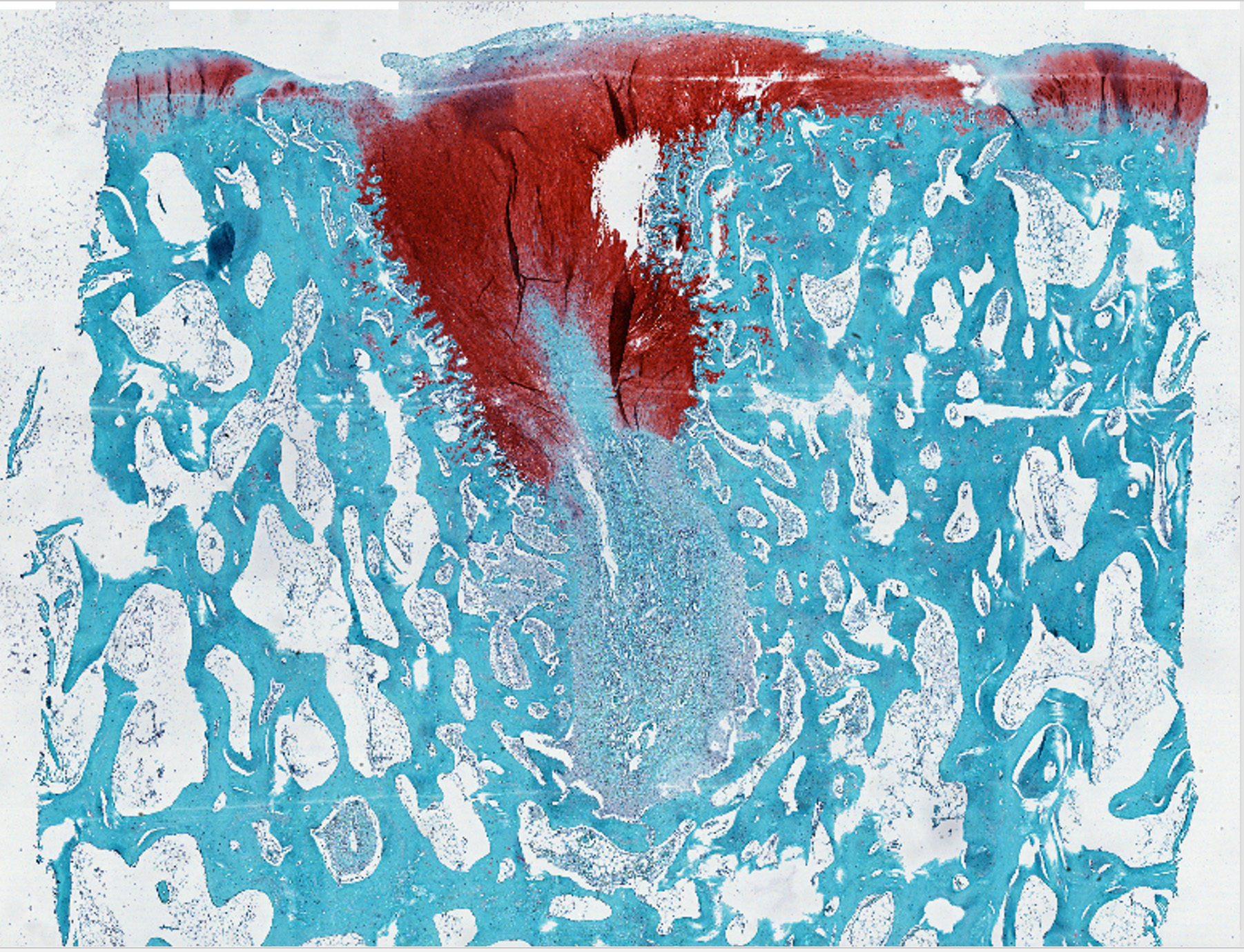 Scientists discover a way to regrow damaged cartilage - Good.is
